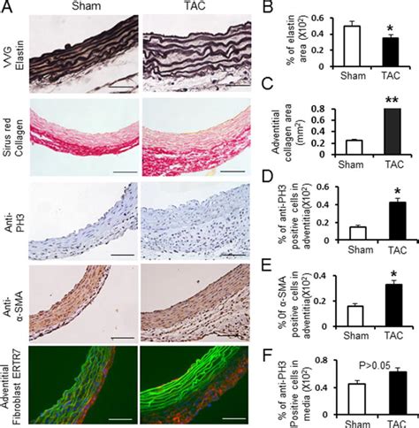 Aortic Remodeling Following Transverse Aortic Constriction In Mice Is