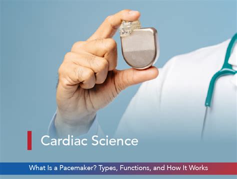 What Is A Pacemaker Types Functions And How It Works Sparsh Hospital