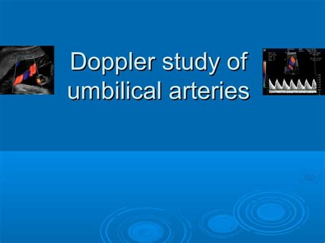 Antenatal Doppler Ppsx