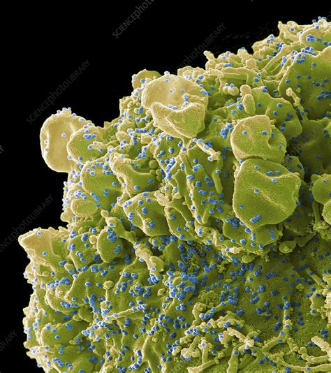 Sars Cov 2 Omicron Variant Sem Stock Image C0572991 Science