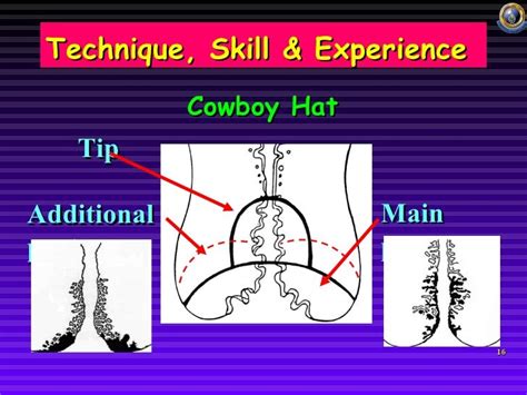 Abnormal Pap Smear ศิริราช Ppt