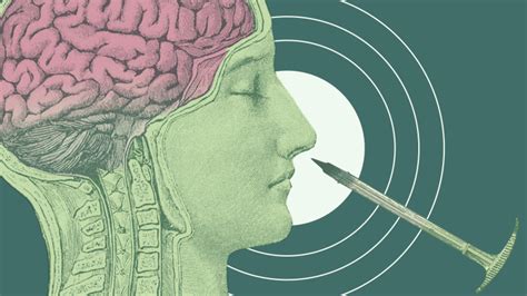 Everything You Never Wanted To Know About The Lobotomy Lifehacker