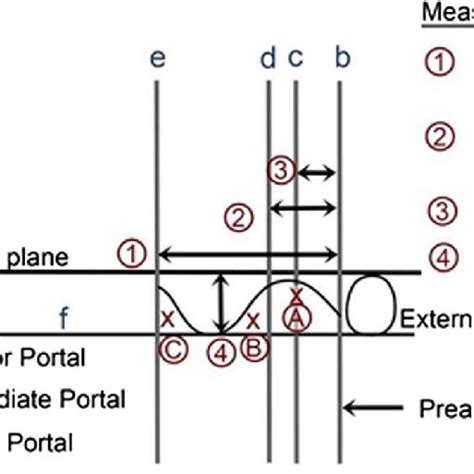 Diagrammatic Representation Of The Coronal TMJ Measurements Download Scientific Diagram