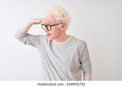 Albino Man See Sun Über 7 lizenzfreie lizenzierbare Stockfotos