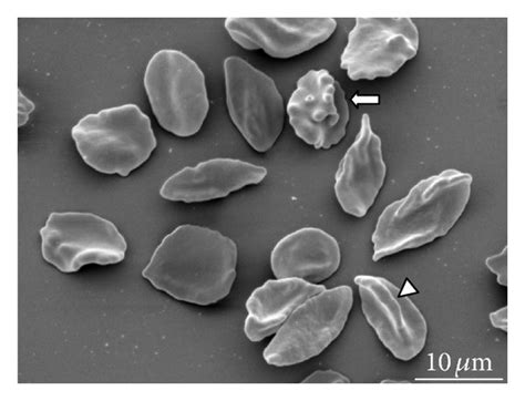 Abnormal Erythrocyte Shapes In Classical Autism At The Scanning
