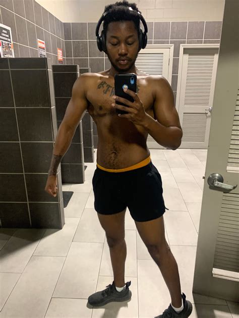 Hello I Had My First Stage Phalloplasty 4 Years And 2 Months Ago And I