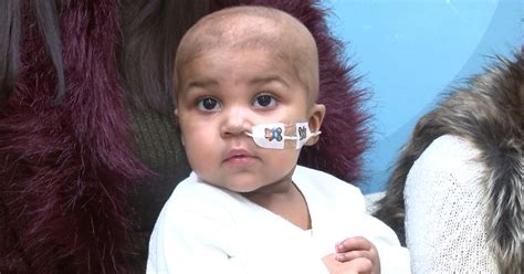 New Gene Editing Technique Treats Baby S Leukemia