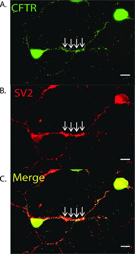 Cftr Co Localizes With A Synaptic Vesicle Protein A Polyclonal