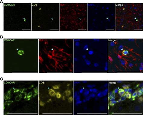 Jci Insight Stem Cellderived Car T Cells Traffic To Hiv Reservoirs