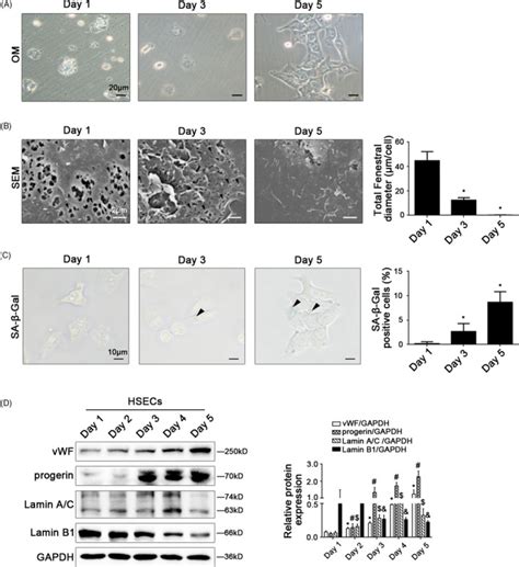 Sirtuin 1 Ameliorates Defenestration In Hepatic Sinusoidal Endothelial