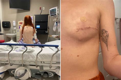 Cancer Survivors Want To Discuss Struggles With Sex After Chemo Npr