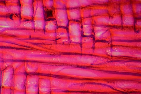 Agarwood Plant Cells Micrograph By Stocksy Contributor Pansfun