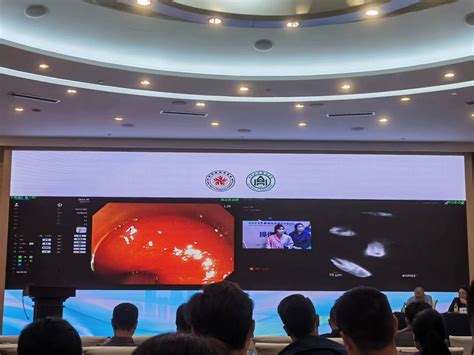 2023齐鲁消化及消化内镜论坛圆满结束 精微视达国产倍晰共聚焦显微内窥镜临床应用再引热议biopsee精微视达【官网】