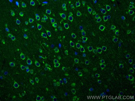 Nmdar2a Grin2a Antibody 83465 2 Rr Proteintech