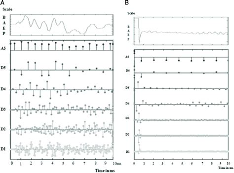 six level decomposition of brainstem auditory evoked potential by