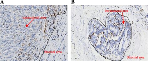 Immunohistochemical Ihc Staining Of Representative Cd4 Expression And