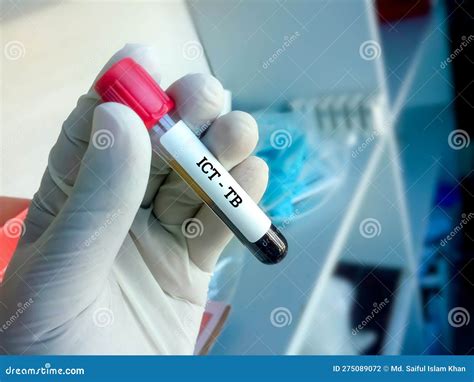 Current Tb Test At Richard Avitia Blog