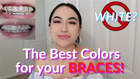 Cool Braces Colors Ideas For Girls