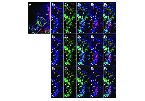 Subcellular Localization Of Eya1 Protein In Otic Vesicle And