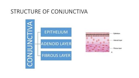 Diseases Of Conjunctiva Ppt Ophthalmology