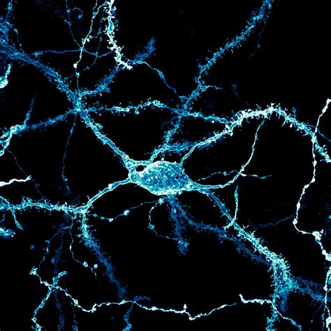 Neuron Densely Covered In Dendritic Spines From The Striatum Of An