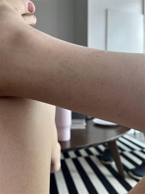 Why Does My Skin Look Like This R Makeupaddiction