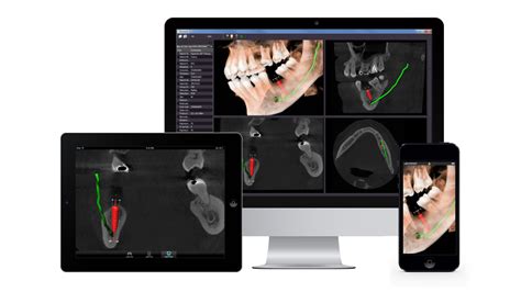 Dental Imaging Open Inventor Toolkit