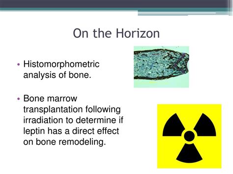 ppt characterizing the skeletal phenotype of db db mice powerpoint
