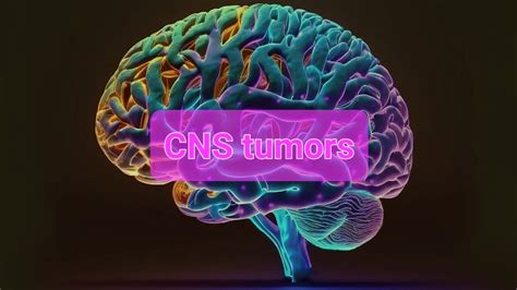 Cns Tumors Ppt Youtube