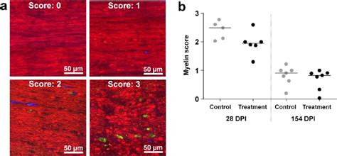 Myelin Morphology A Different Myelin Morphology In Label Free Download Scientific Diagram