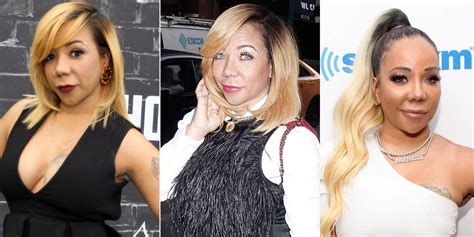 Tiny Harris Before And After Plastic Surgery