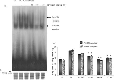 Nf κb Dna Binding Activity In The Liver Of N Dl And Curcumin Treated