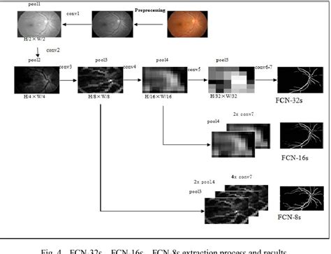Figure 1 From Vessel Recognition Of Retinal Fundus Images Based On Fully Convolutional Network