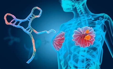 Sacituzumab Govitecan Is Associated With Better Pfs And Os Regardless