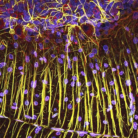 Cerebellum Tissue Light Micrograph Stock Image P360 0432 Science Photo Library