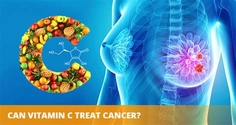 High Dose Vitamin C Selectively Kill Cancer Cells Liposomal Vitamin C