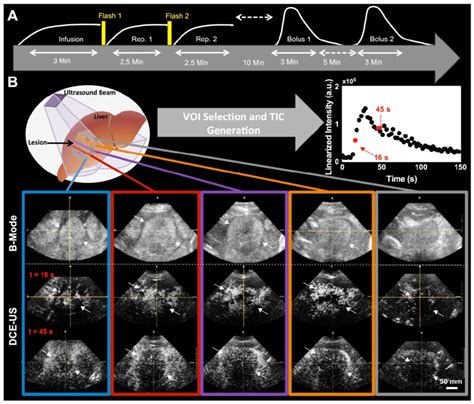 A Overview Of Imaging Workflow To Assess Repeatability Of The Two 3d