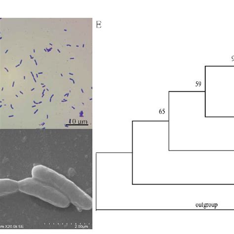 Morphological Identification And Phylogenetic Tree Of Lactobacillus