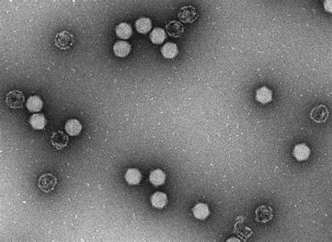 Adenoviral Vectors Tem Imaging Analysis Services Qutem