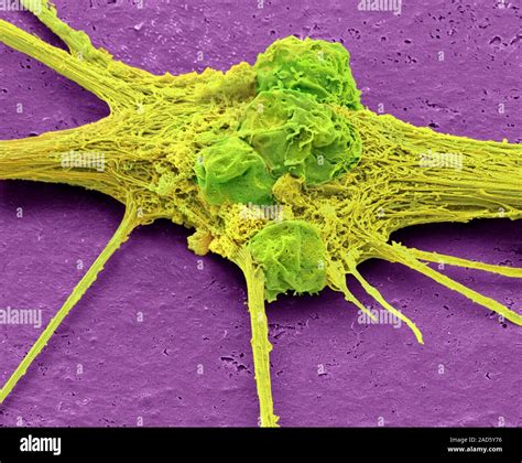 Stem Cell Derived Neuron Coloured Scanning Electron Micrograph Sem