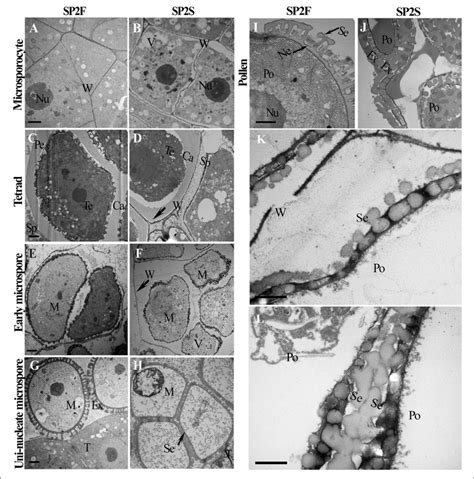 Transmission Electron Micrographs Of Microspore And Pollen Download Scientific Diagram