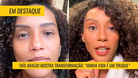 Cenapop Ex Chiquititas Mostra Antes E Depois Na Web Voltar A Ser