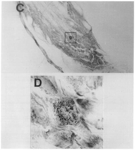 Hrp Evidence Of Sensory And Motor Vagal Innervation Of The Uterus A