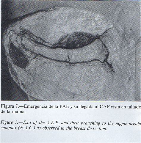 Breast Artery System Anatomical Dissections Sistema Arterial