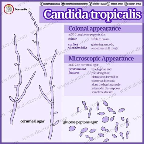 Best 13 Comprehensive Guide To Staphylococcus Lugdunensis Biology Pathogenesis And Treatment
