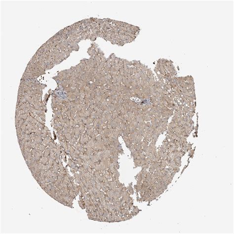 Tissue Expression Of Fn1 Staining In Liver The Human Protein Atlas