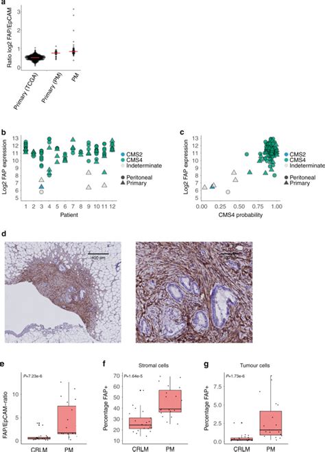 Fibroblast Activation Protein Identifies Consensus Molecular Subtype 4