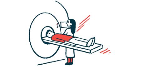 Sma Patients With Less Muscle Loss Respond Better To Spinraza Sma