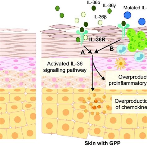 Il 36 Signaling Pathway In Normal Skin And In Skin With Gpp Download
