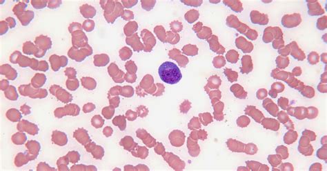 How To Nudge People Toward Smarter Cancer Screening Decisions